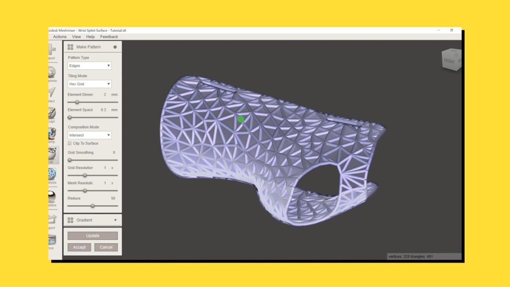 Designing 3D Printed Splints and Orthoses at Prepa UDEM